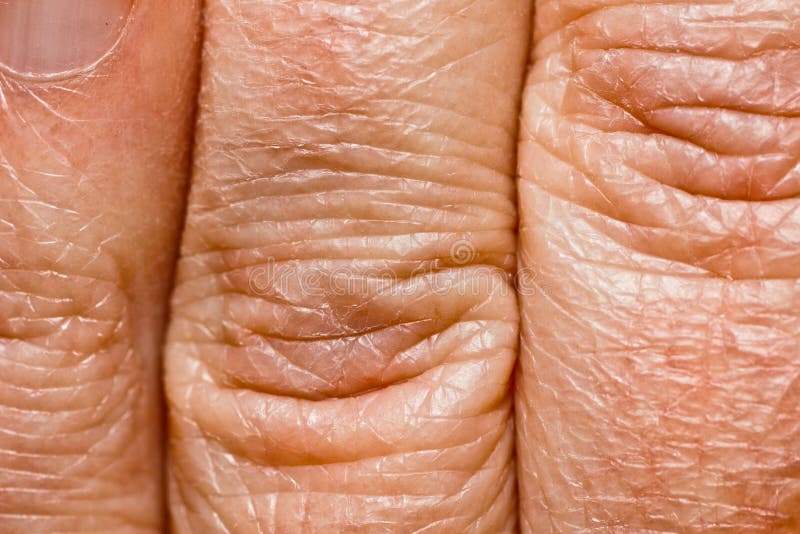 Human skin stock image. Image of background, textured - 17108889