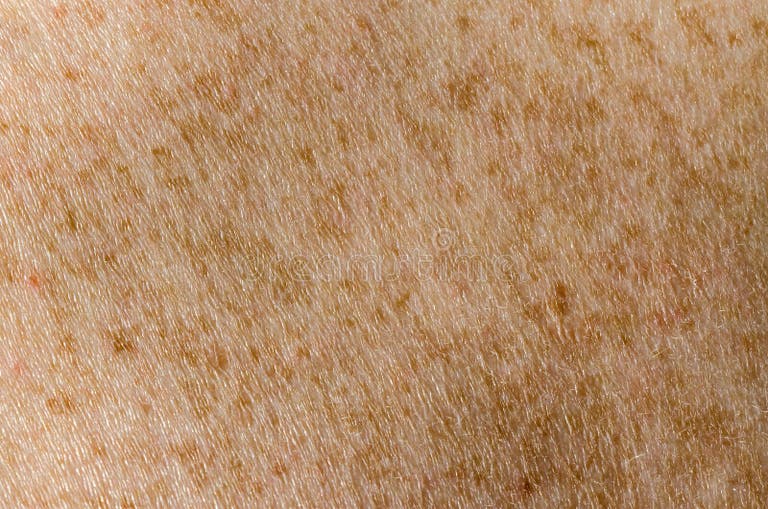 406 Freckled Skin Texture Stock Photos - Free & Royalty-Free Stock ...