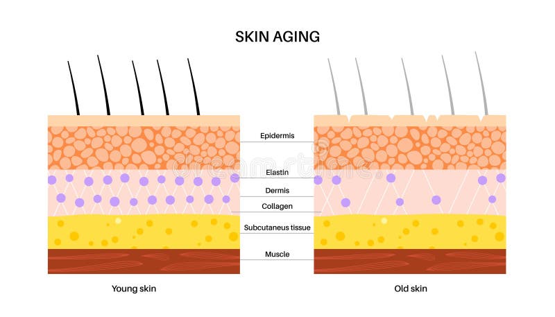 Skin aging poster stock vector. Illustration of care - 278943736