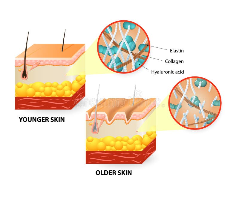Skin Aging. Difference between the Skin of a Young and Elderly P Stock ...