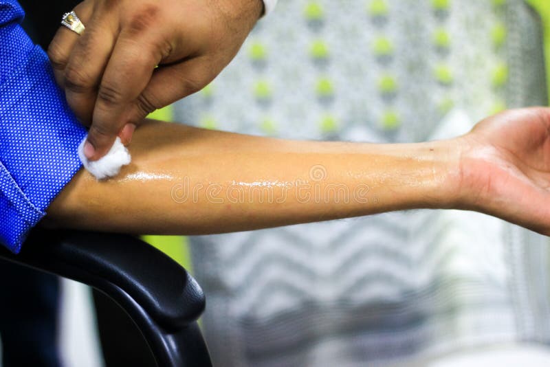 Skin Allergy Test Preparation by Doctor on a Patient Hand Showing the ...