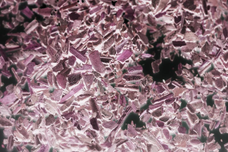 Skin Cells Under a Microscope Stock Image - Image of magnification ...