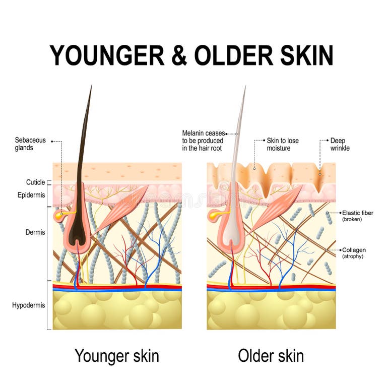 Skin Changes or Ageing Skin. Stock Vector - Illustration of fibre ...