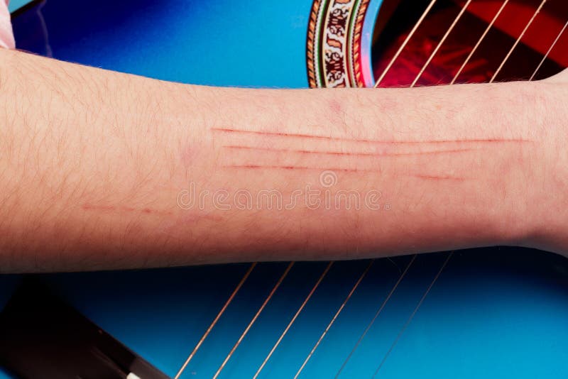 223 Cat Scratch Skin Photos - Free & Royalty-Free Stock Photos from ...