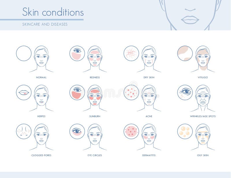 Skin conditions stock vector. Illustration of facial - 78505574