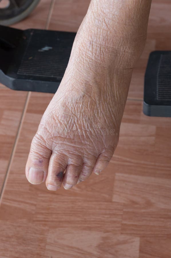 Skin of the elderly stock photo. Image of woman, senescent - 73790472