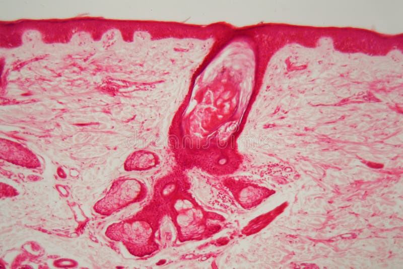 Skin with Follicle Under the Microscope Stock Image - Image of ...