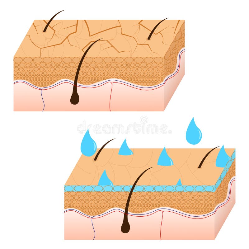 Skin Hydration and Dry Skin Sectional View. Stock Vector - Illustration ...