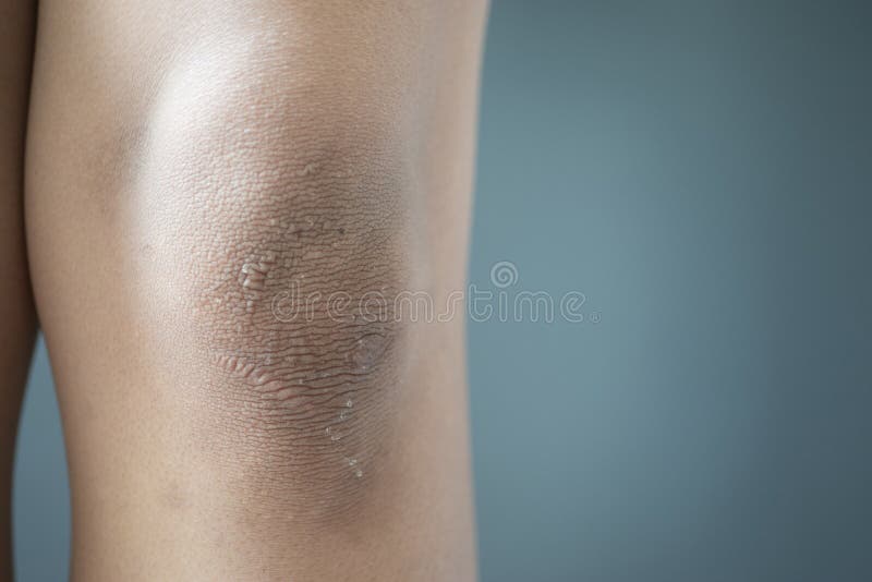 The Skin of the Knees is Wrinkled and Rough Stock Photo - Image of skin ...