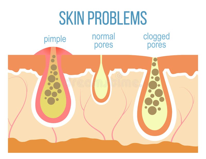 Skin pores close up stock vector. Illustration of beauty - 90922065 Skin pores close up stock vector. Illustration of beauty - 90922065