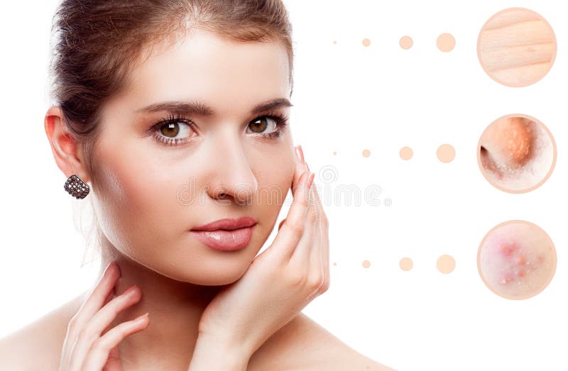 Skin problem of woman face stock image. Image of makeup - 85674045
