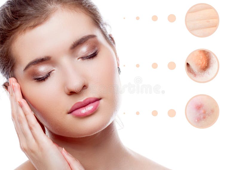 Skin problem of woman face stock photo. Image of complexion - 85674154