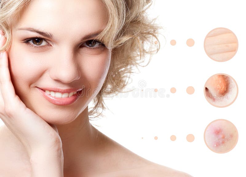 Skin problem of woman face stock photo. Image of natural - 85675190