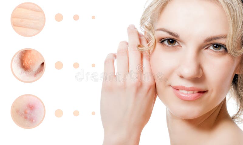 Skin problem of woman face stock image. Image of eyes - 85890411