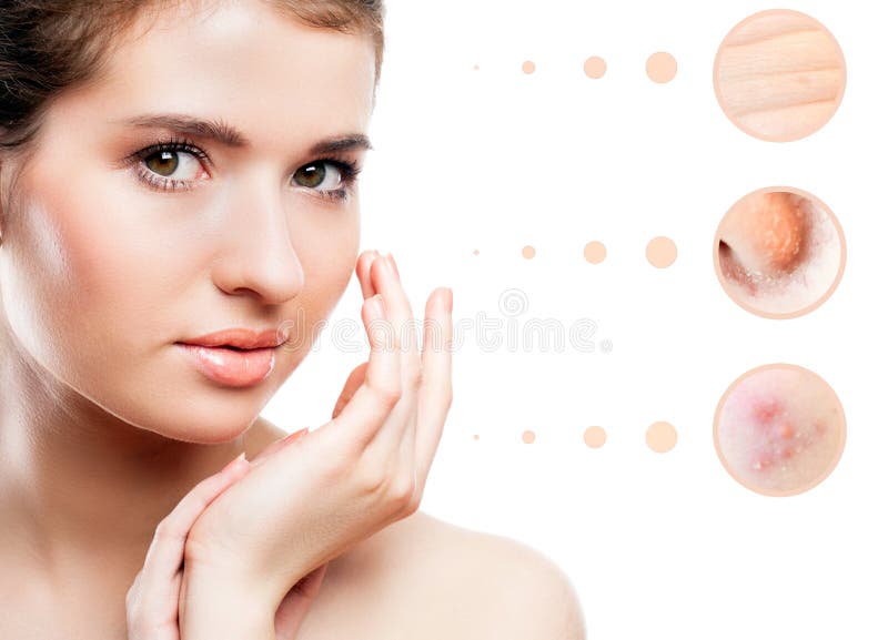 Skin problem of woman face stock photo. Image of adult - 85674132