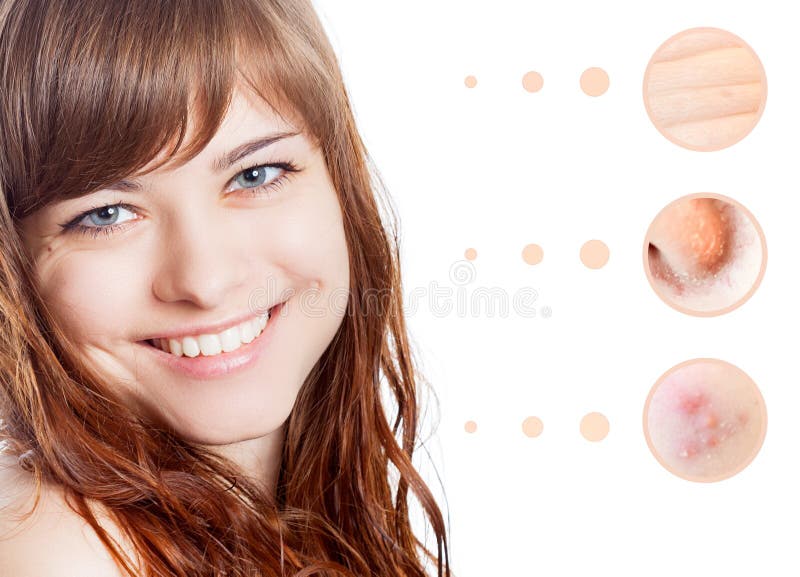 Skin problem of woman face stock image. Image of beautiful - 85890463