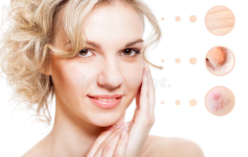Skin problem of woman face stock image. Image of complexion - 85890483