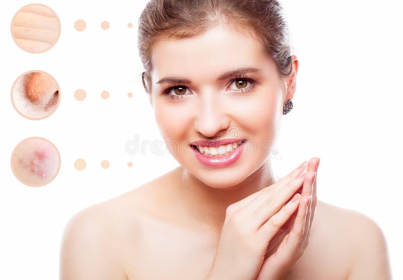 Skin problem of woman face stock photo. Image of girl - 85890522
