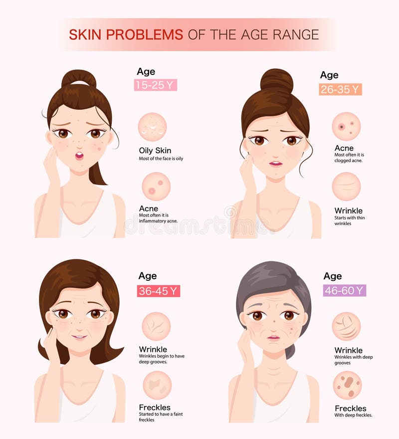 Skin Problems of the Age Range Stock Illustration - Illustration of ...