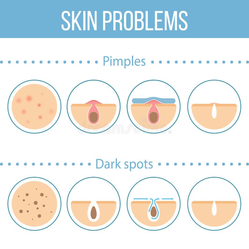 Skin problems icons stock vector. Illustration of cosmetic - 74671641