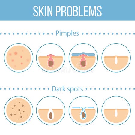 Skin problems icons stock vector. Illustration of cosmetic - 74671641