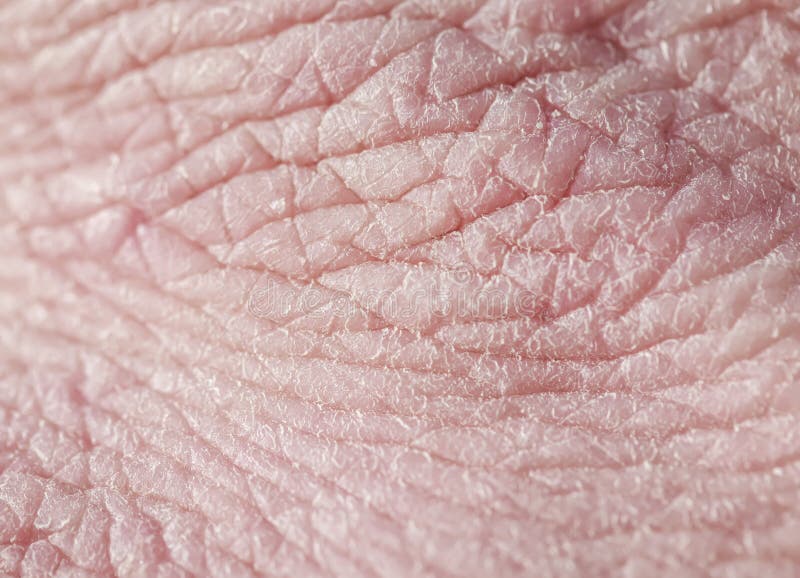Skin Texture Of The Neck And Cheeks Of A Young Man Covered With Hair ...