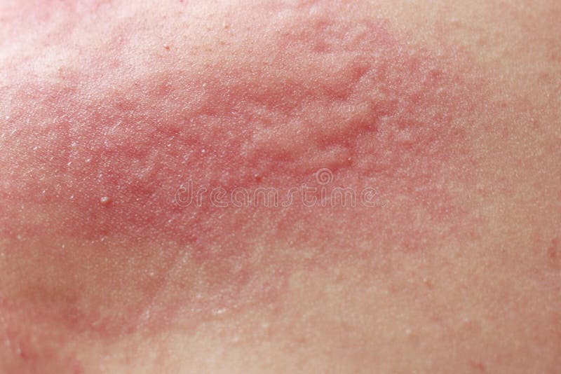 Skin texture stock photo. Image of integument, caucasian - 67247282