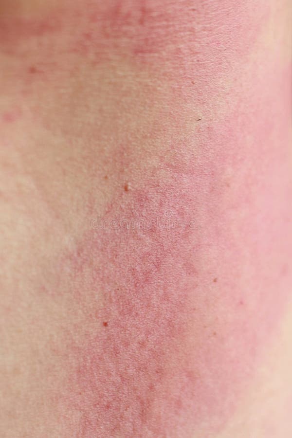 Skin texture stock image. Image of body, health, girl - 67248779