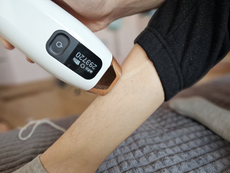 Skin Treatment in Progress Using a Handheld Device for Hair Removal at ...