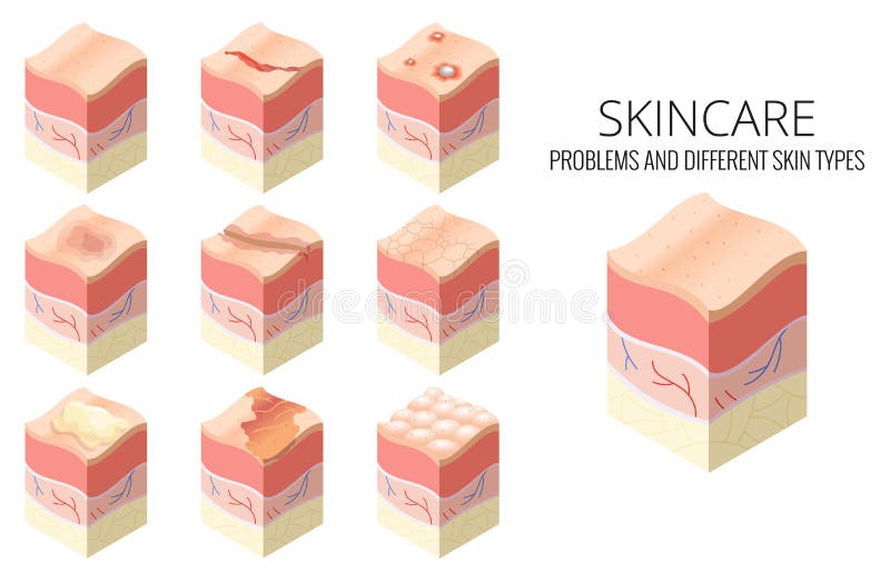 Skincare Medical Concept. Set of Problems of Different Skin Types in ...