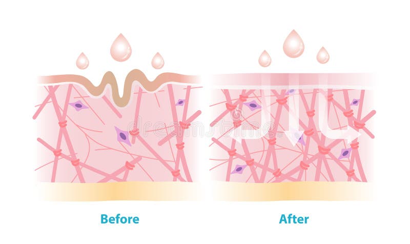 Rejuvenate Stock Illustrations – 8,782 Rejuvenate Stock Illustrations ...