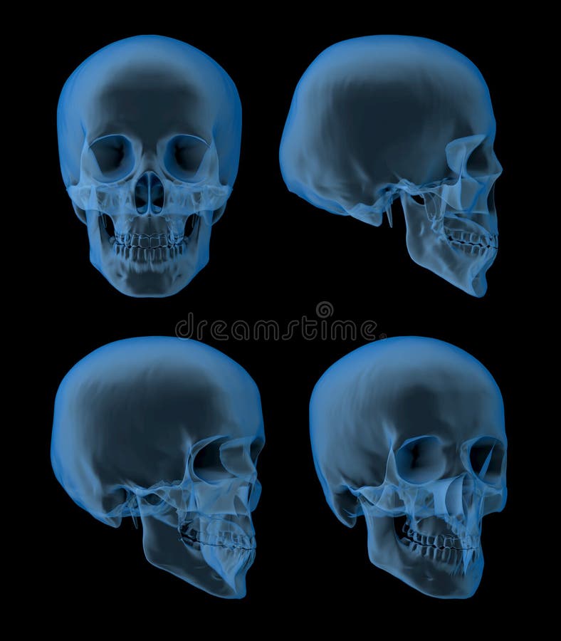 Skull x-ray, views stock image. Image of side, science - 51402309