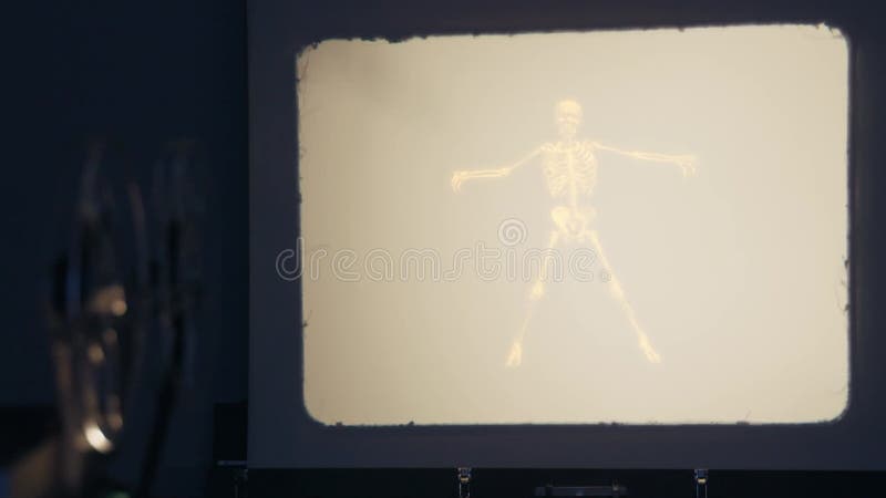 Human Skull in the TV Screen and Projector Stock Footage - Video of ...