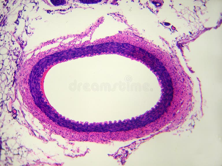 Slagader PK N4826 stock foto. Image of ziekte, anatomie - 3942518