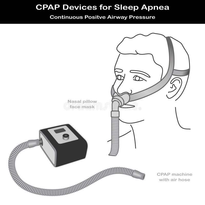 Sleep Apnea, CPAP Machine, Nasal Pillow Mask Stock Vector ...