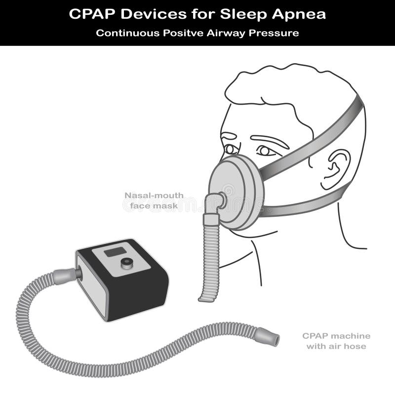 Cpap Happy Stock Illustrations – 108 Cpap Happy Stock Illustrations ...