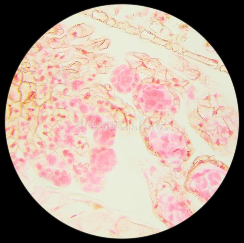 Slice Fern Leaf Under a Microscope, (Fern Leaf Sec.), Stock Photo ...