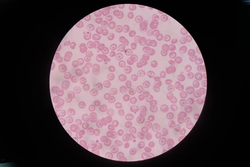 Slide blood smear stock photo. Image of tube, test, sample - 80361036