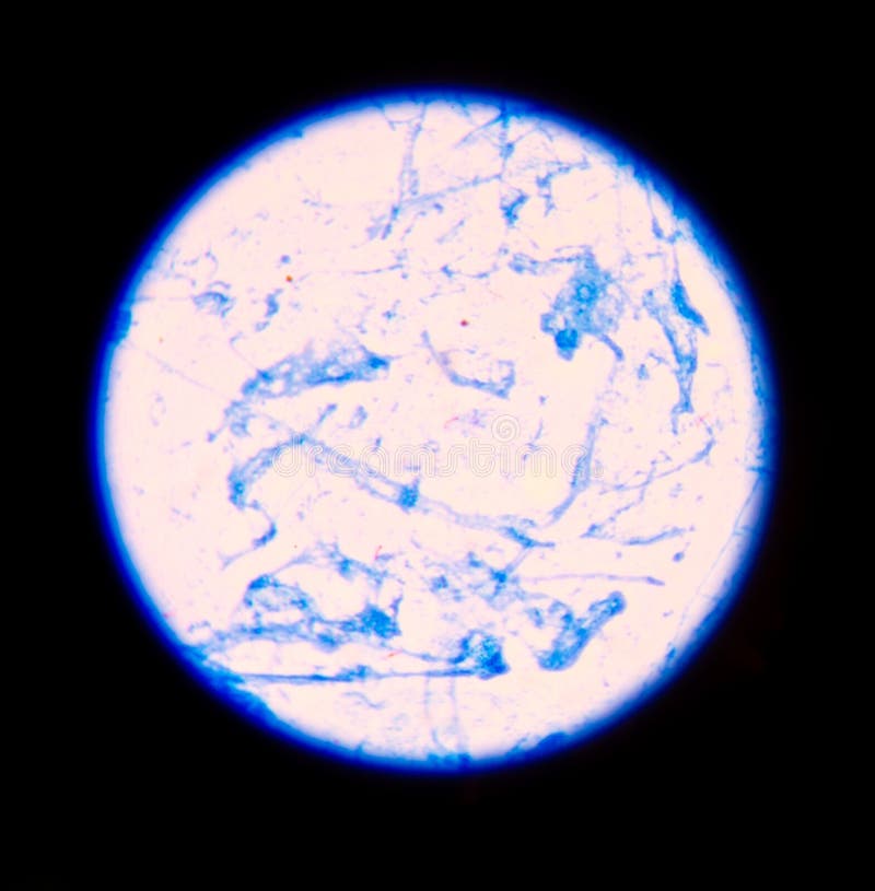 Slide sputum AFB. stock photo. Image of bacteria, microscopic - 58211986