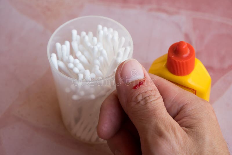 A Slight Wound in the Right Thumb is Bleeding. Therefore Need To Put ...