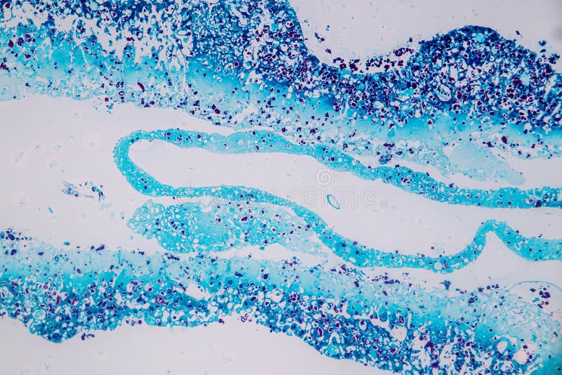 Slime Molds, As a Group, are Polyphyletic. Stock Photo - Image of ...