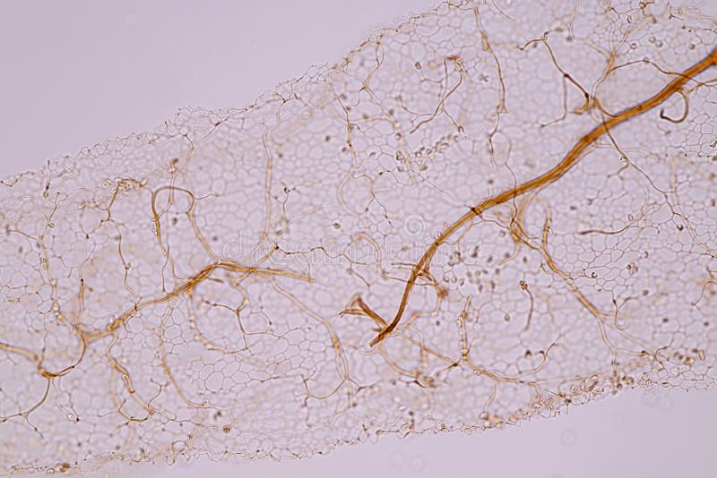 Slime Molds, As a Group, are Polyphyletic. Stock Photo - Image of ...