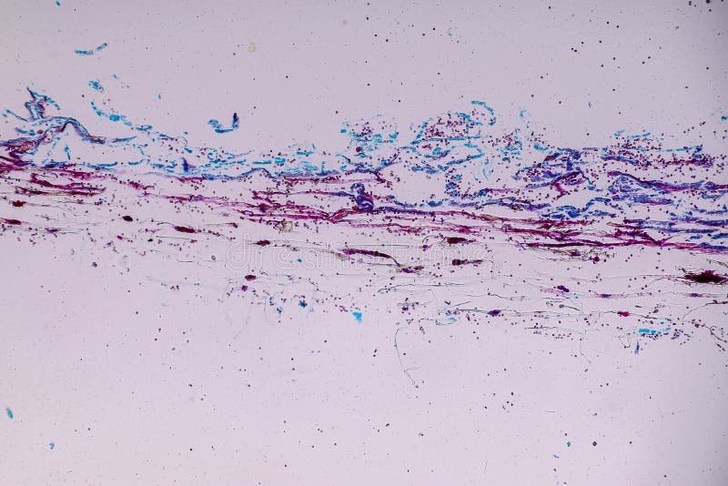 Slime Molds, As a Group, are Polyphyletic. Stock Photo - Image of cells ...