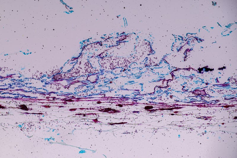 Slime Molds, As a Group, are Polyphyletic. Stock Image - Image of close ...