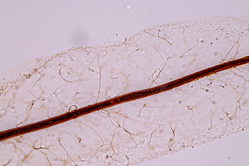 Slime Molds, As a Group, are Polyphyletic. Stock Image - Image of cells ...