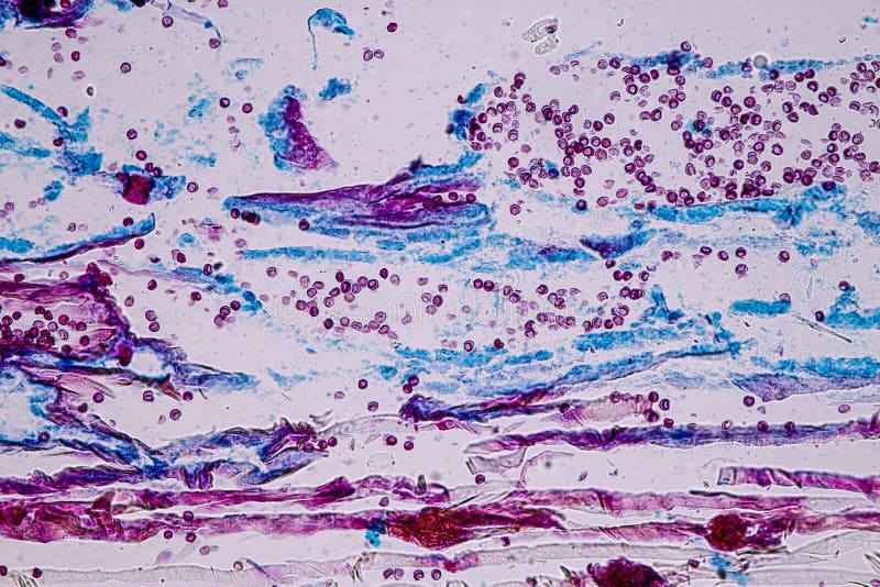 Slime Molds, As a Group, are Polyphyletic. Stock Photo - Image of cycle ...