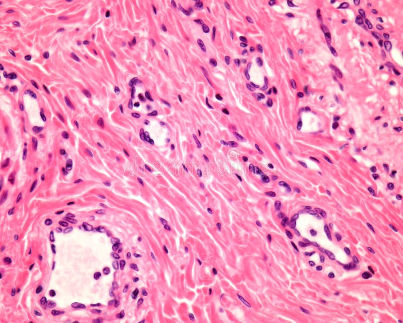 Slokdarmsubmucosa Bindweefsel Stock Foto - Image of microscoop ...