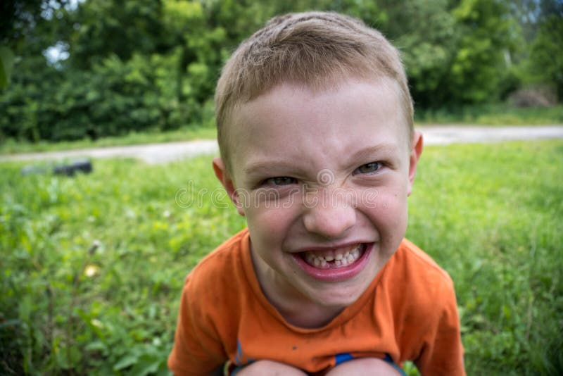 Small Child Lost the First Tooth Stock Photo - Image of exercise ...