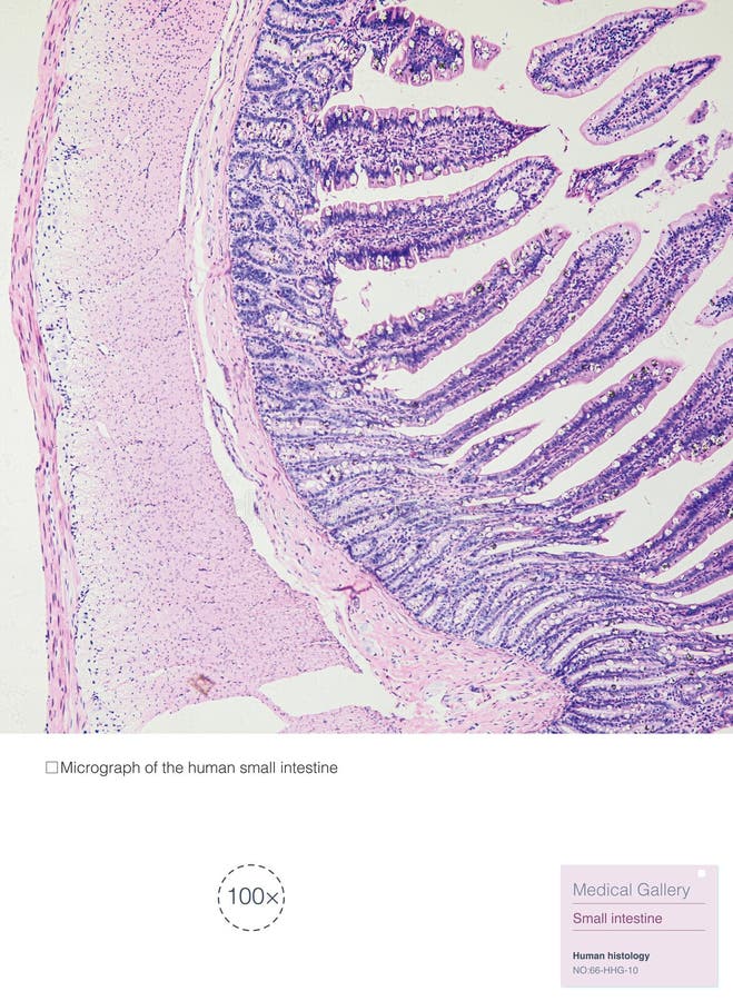 Human small intestine stock image. Image of blood, small - 343905665
