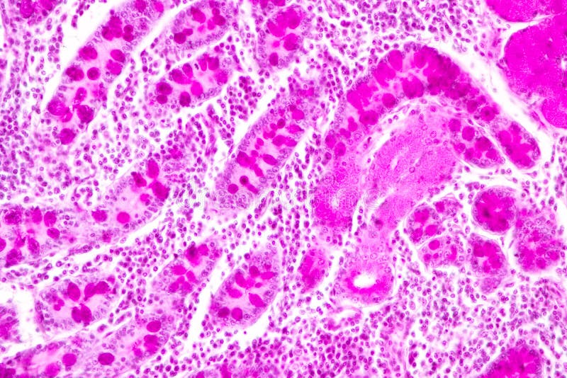 Small Intestine Duodenum and Vermiform Appendix Human Under the ...